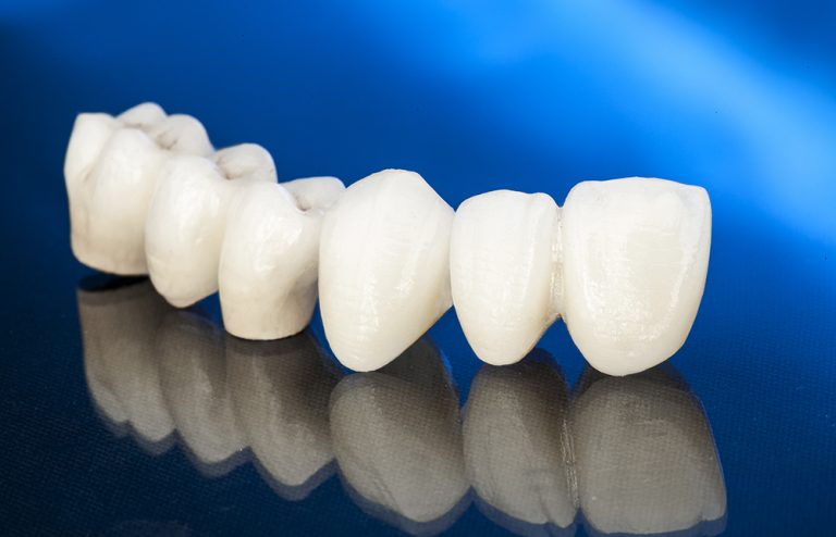 Before Endodontic Treatment | Apex Endodontics